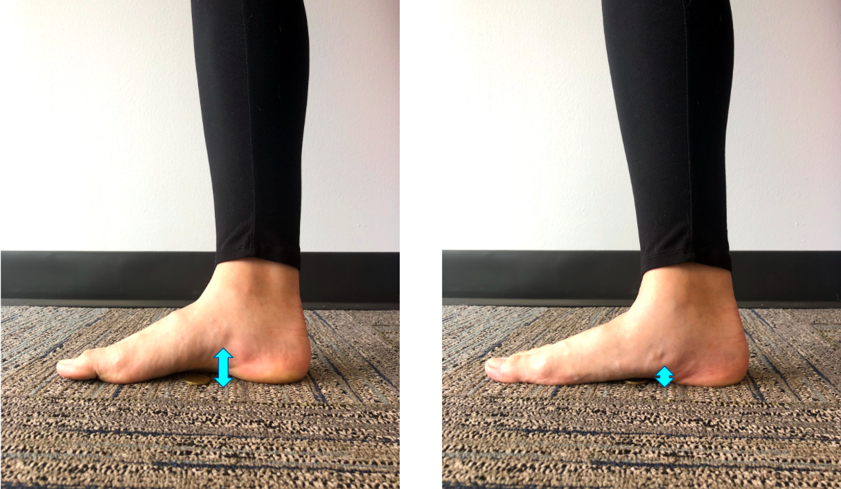 Pure Barre: Foot Posture Corrections — Precision Physical Therapy