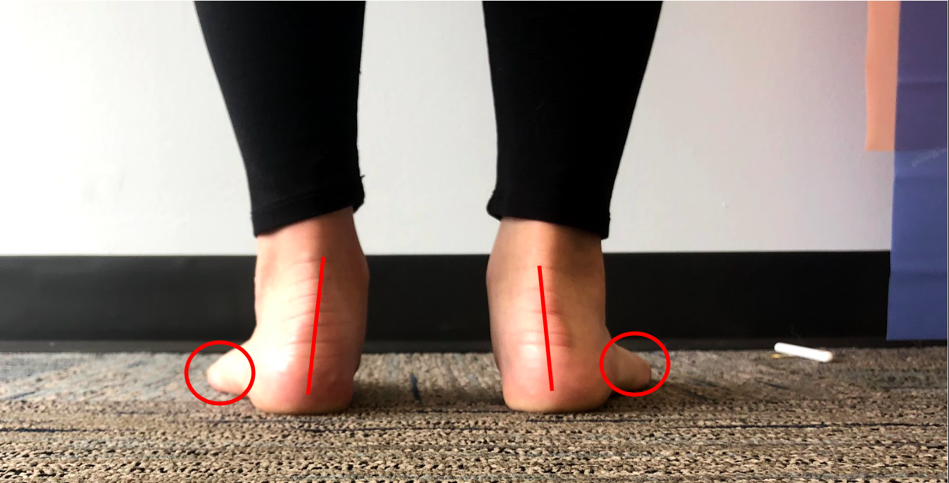 Pure Barre: Foot Posture Corrections — Precision Physical Therapy
