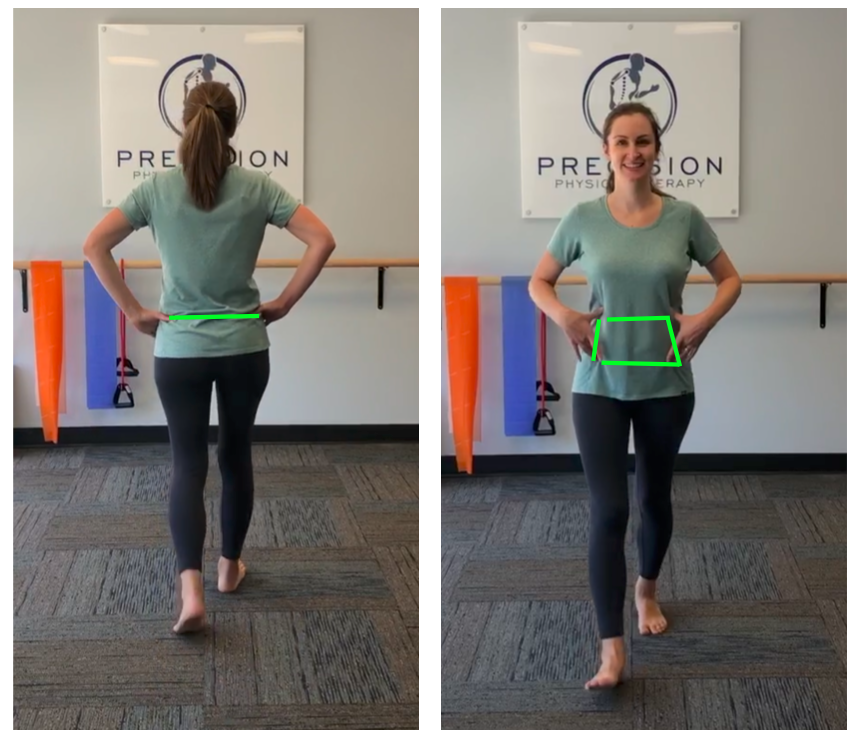 Pure Barre: Stability While Walking — Precision Physical Therapy