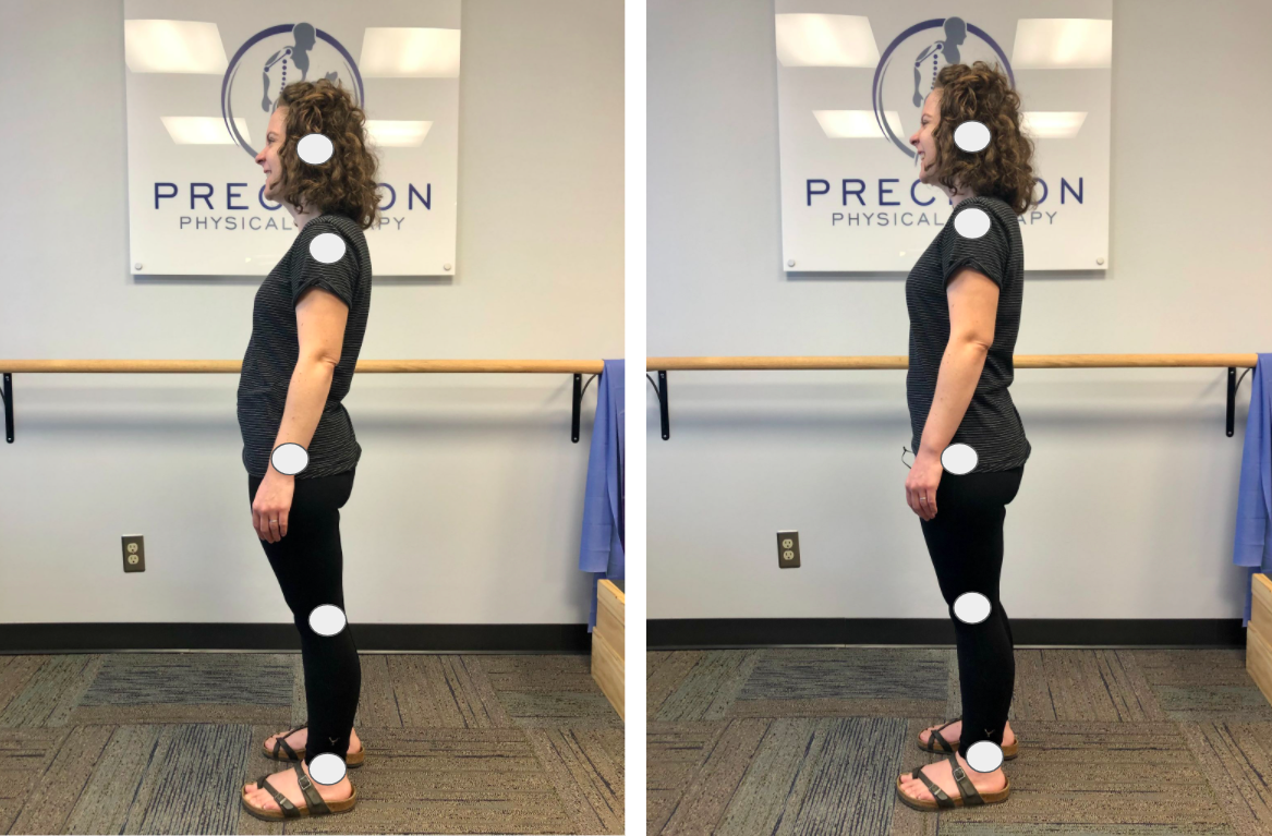 Can you fix slouched posture? — Precision Physical Therapy