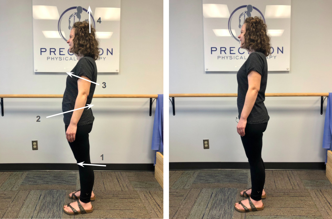 Can you fix slouched posture? — Precision Physical Therapy