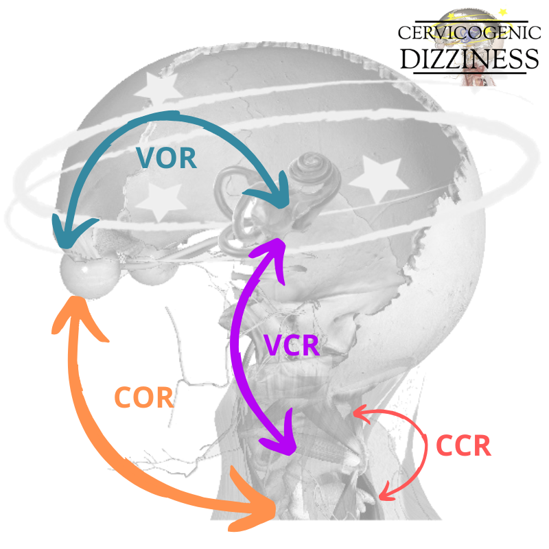 Cervicogenic Dizziness — Cervicogenic Dizziness