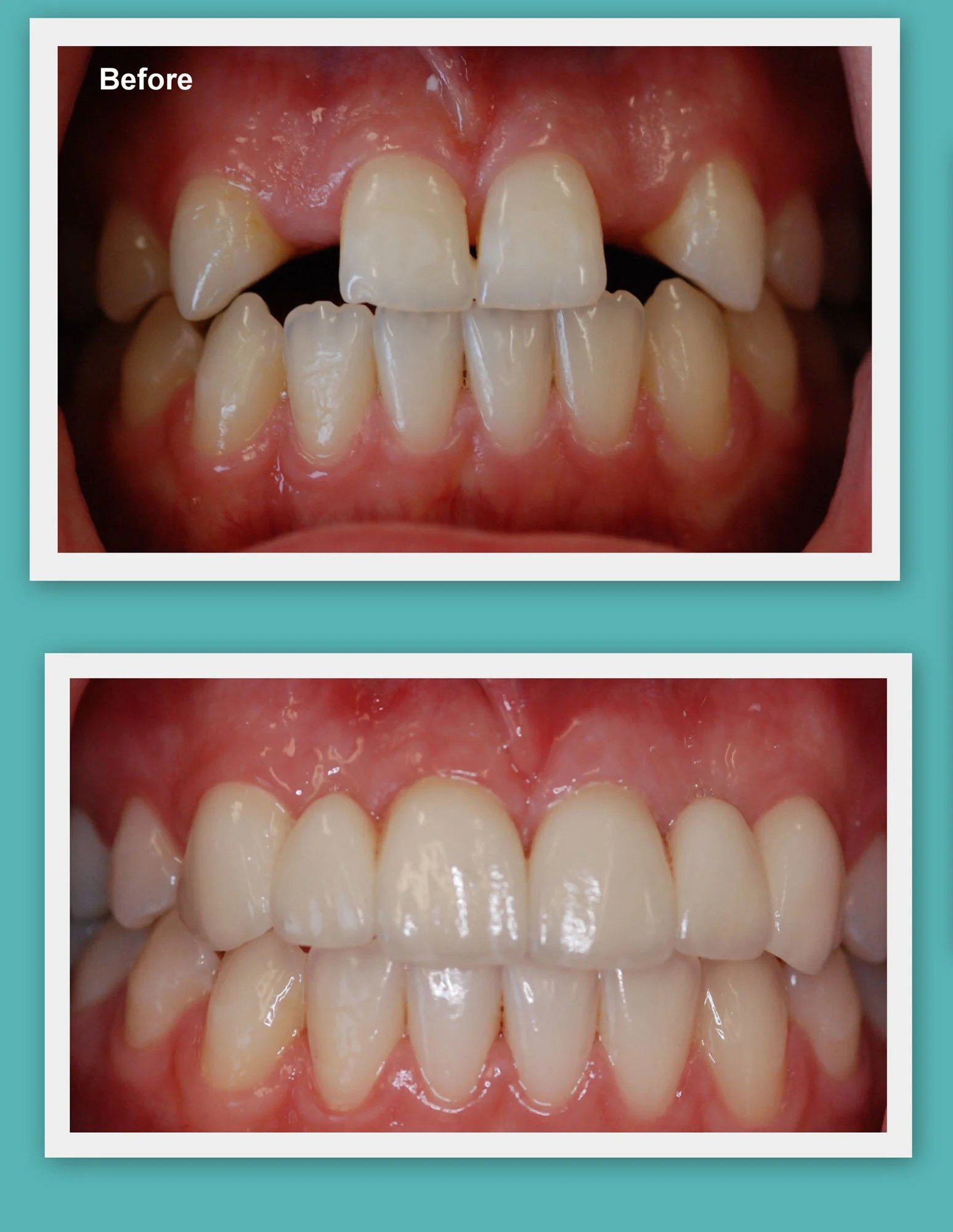 before and after gallery — 624 Dental