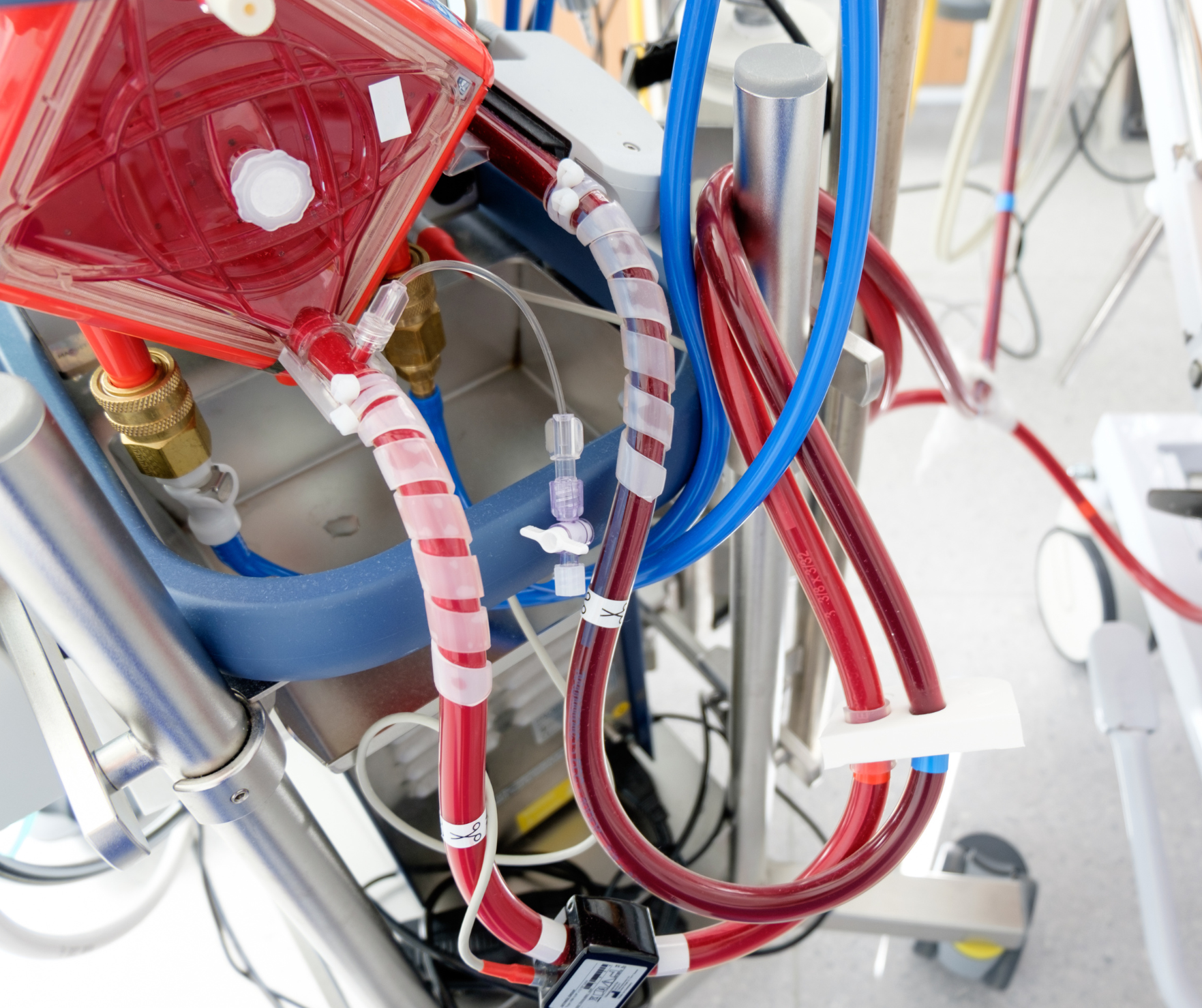 VACEP EBM Series: Utilization of Extracorporeal Membrane Oxygenation ...