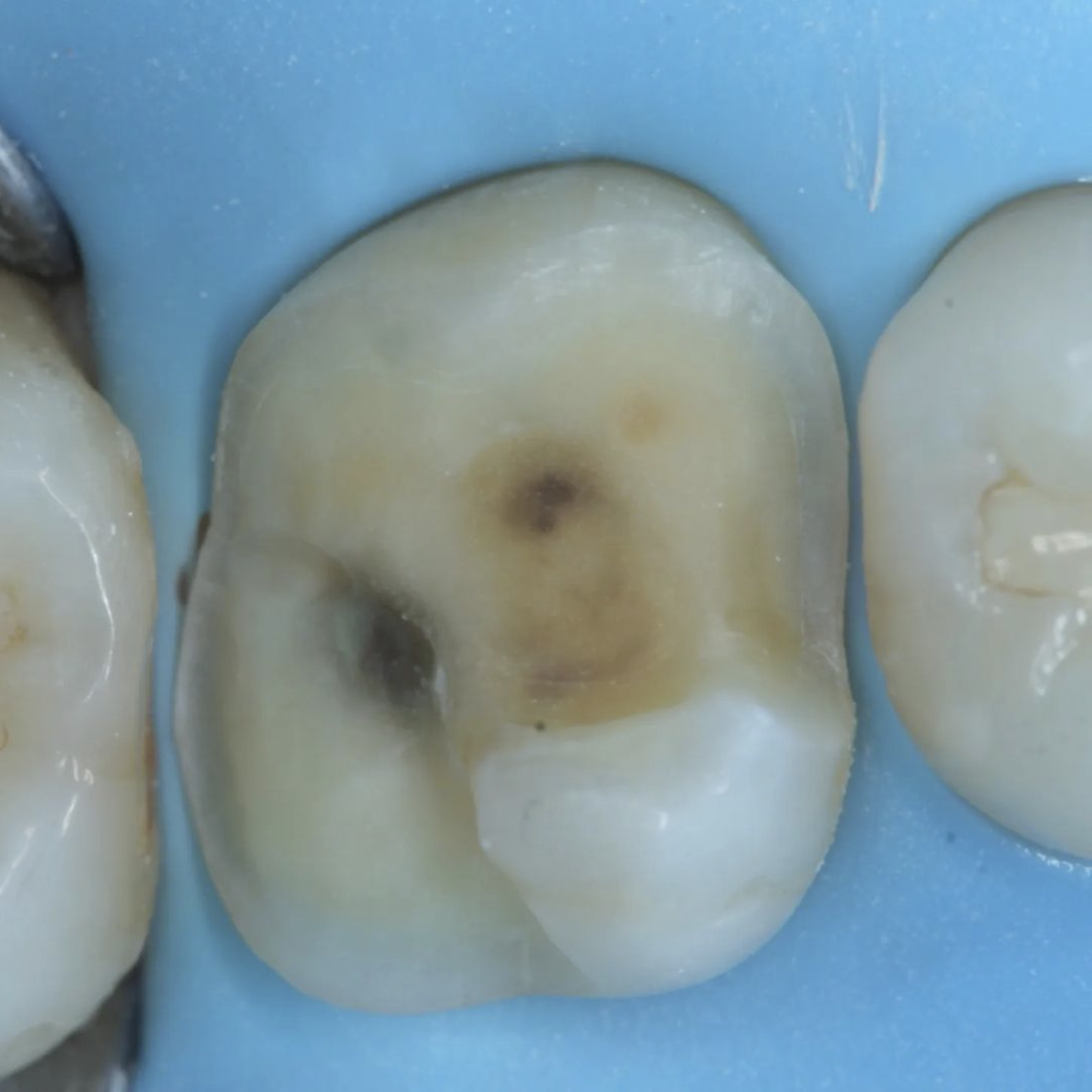 See Our Work — Alleman Center of Biomimetic Dentistry