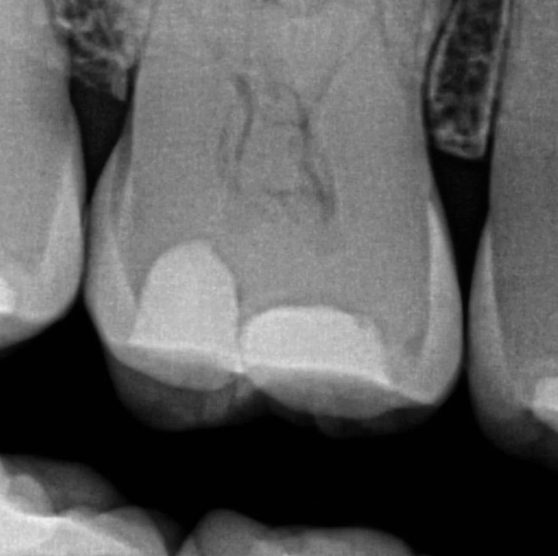 See Our Work — Alleman Center of Biomimetic Dentistry