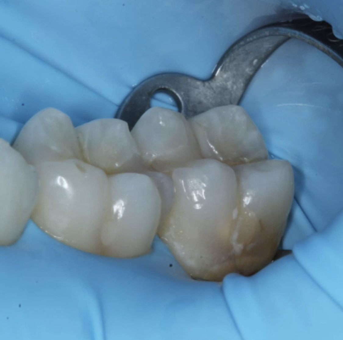 See Our Work — Alleman Center of Biomimetic Dentistry