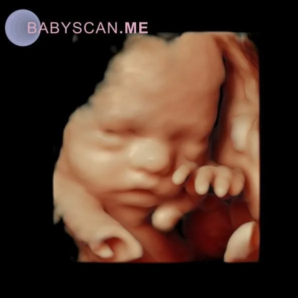 Scans — babyscan.me