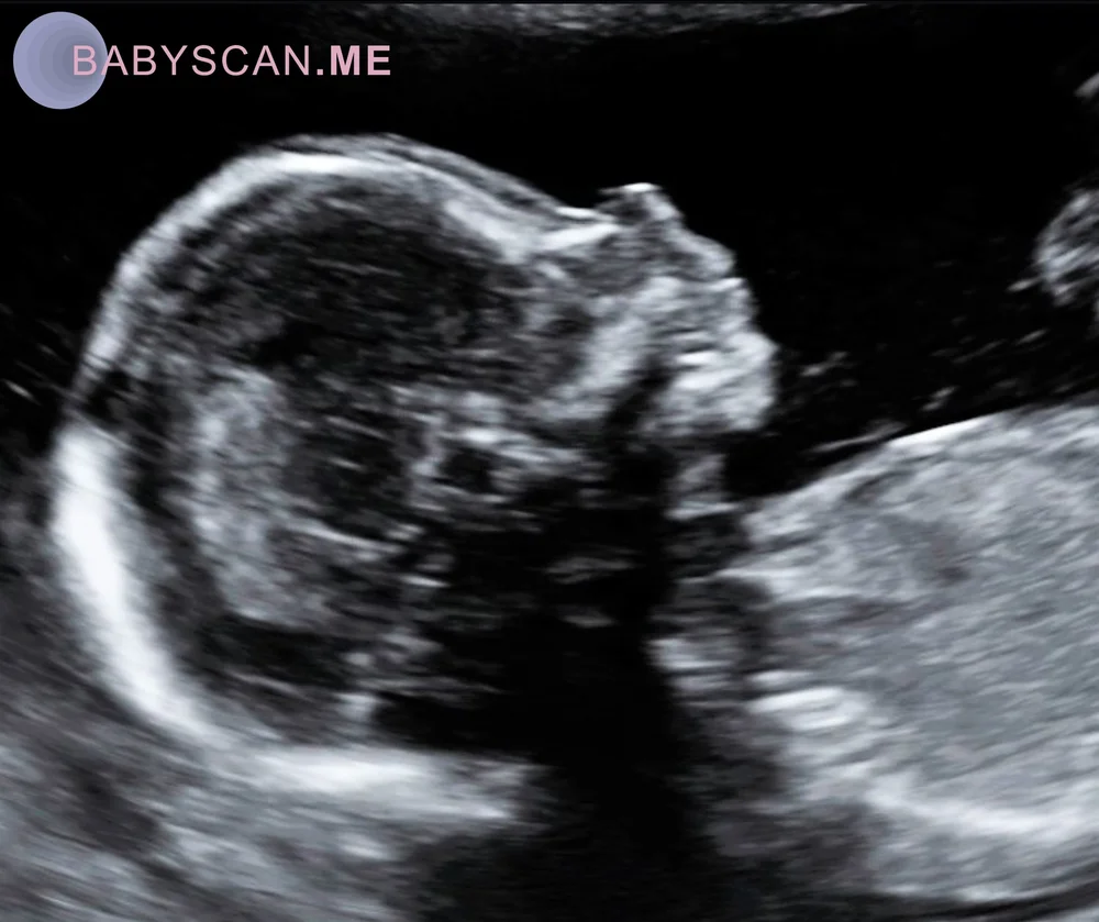 Scans — babyscan.me