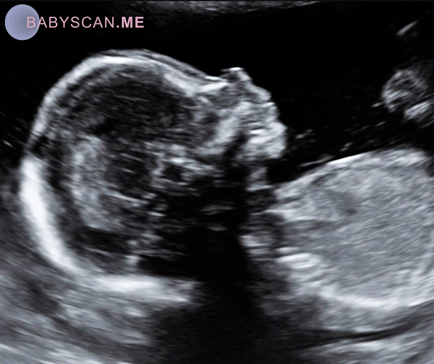babyscan.me
