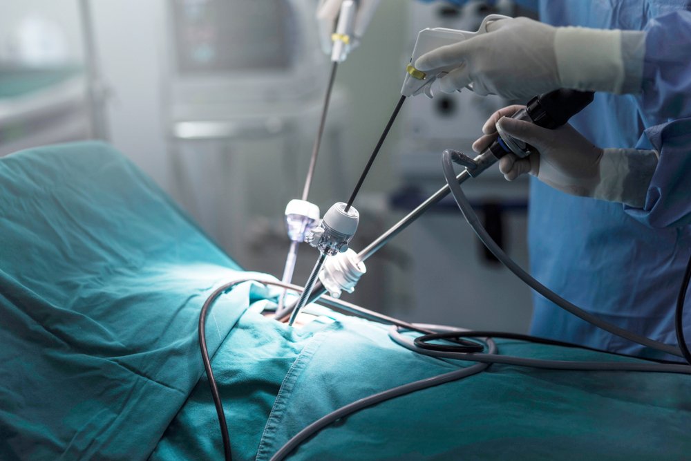 Minimally Invasive Surgery Mis Robotic Surgery Vs Laparoscopic