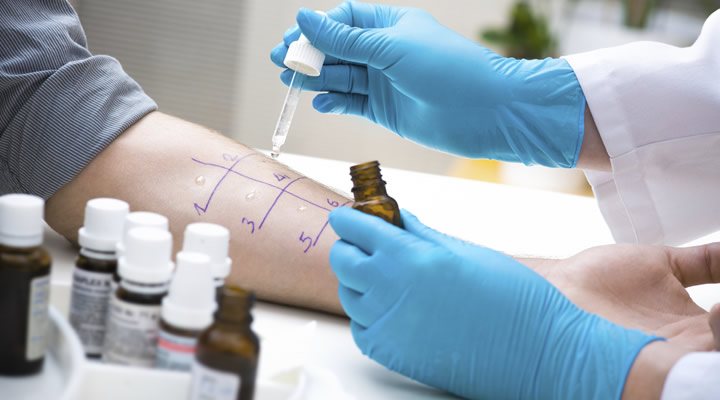 Instruction for Allergy Skin Testing — AIANE: Allergy & Immunology ...