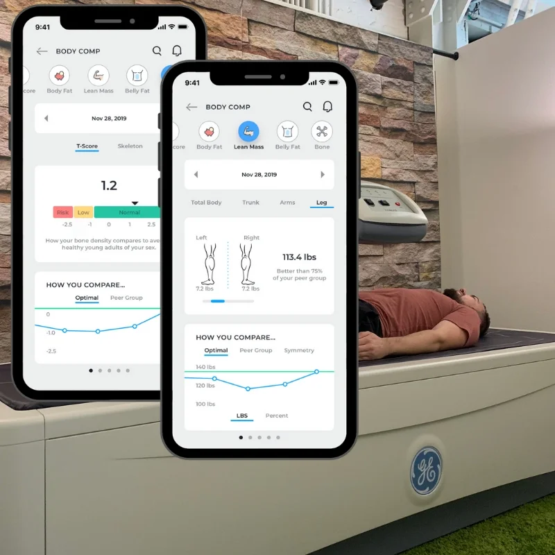 DEXA Body Composition Analysis in Asia — DexaFit Singapore