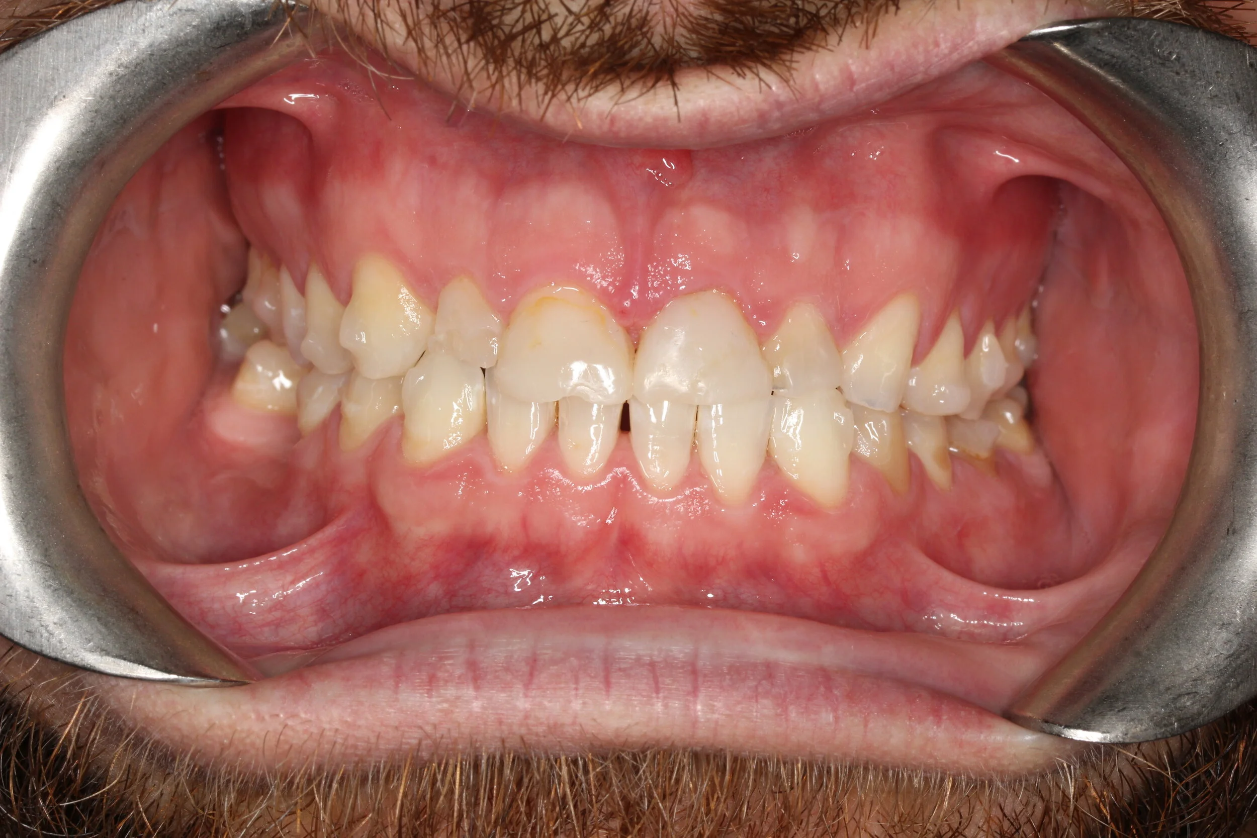 Cosmetic Restorative Cases — Ala Moana Dentistry