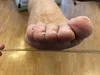 Les déformations de l'avant Pied — Cabinet de Podologie Raspail Paris 7 ...