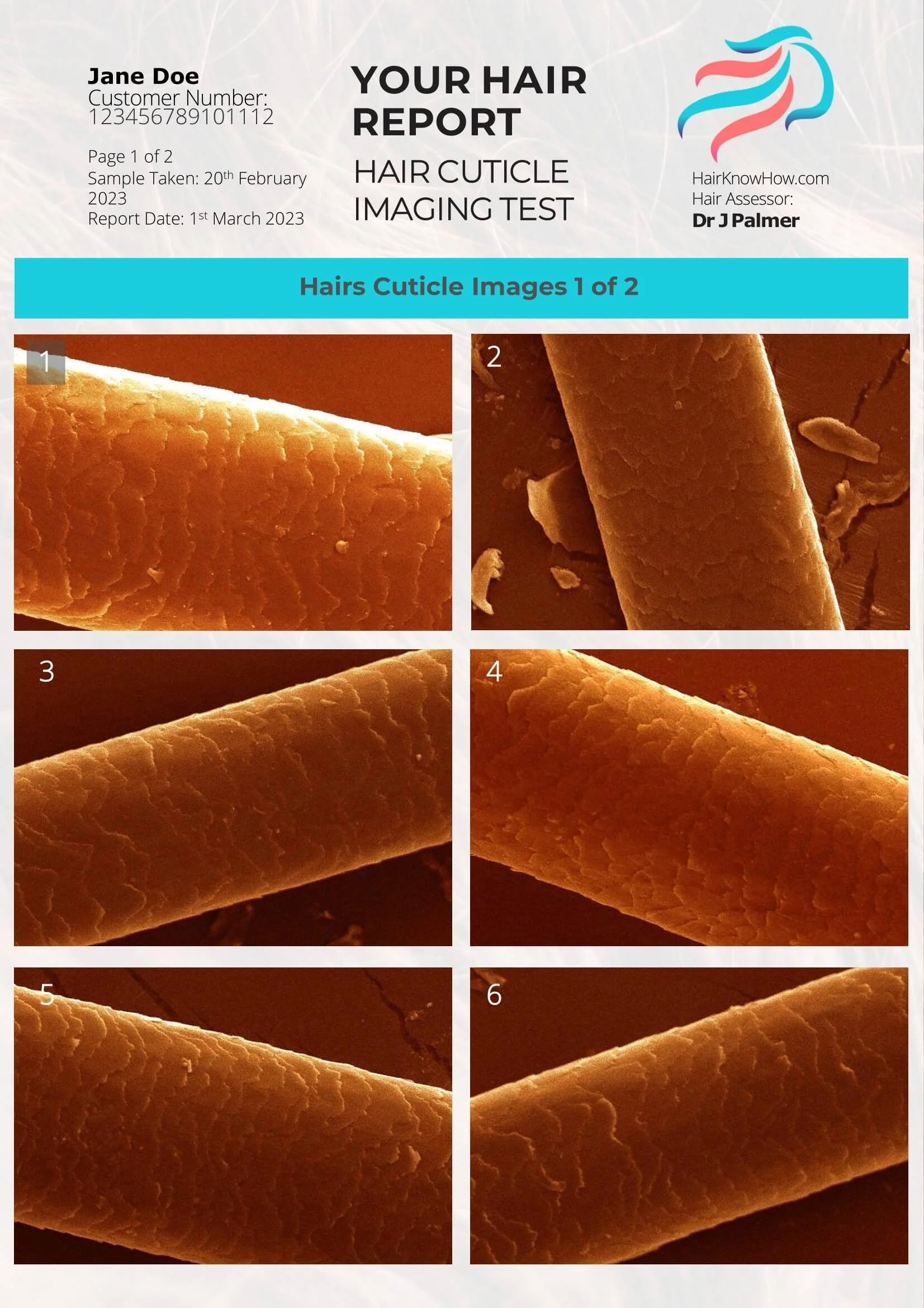 A New Hair Clinic Testing Tool - The Cuticle Imaging Test — HairKnowHow ...