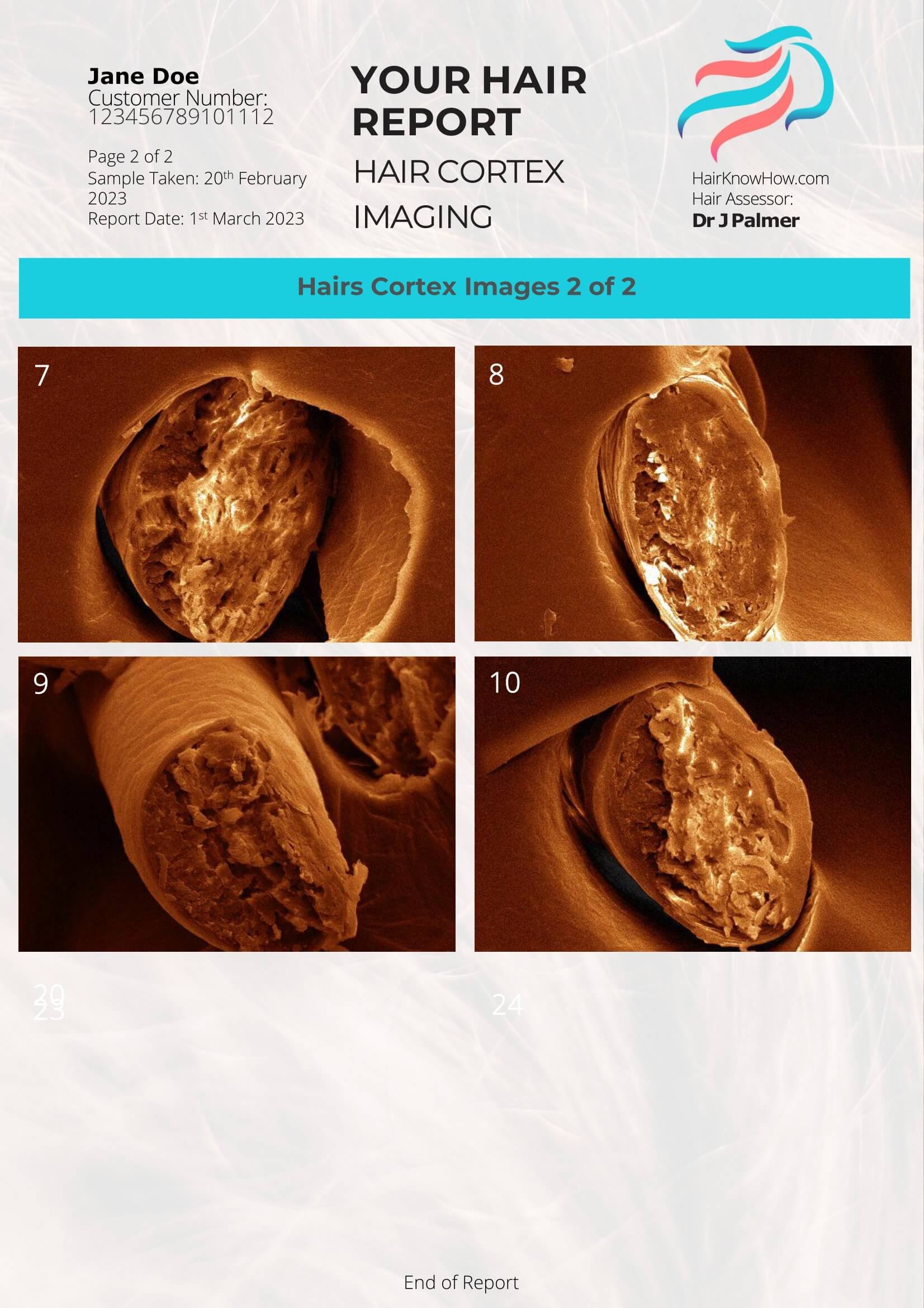 HairKnowHow: Hair Clinic Cortex Imaging Test Services — HairKnowHow.Com ...