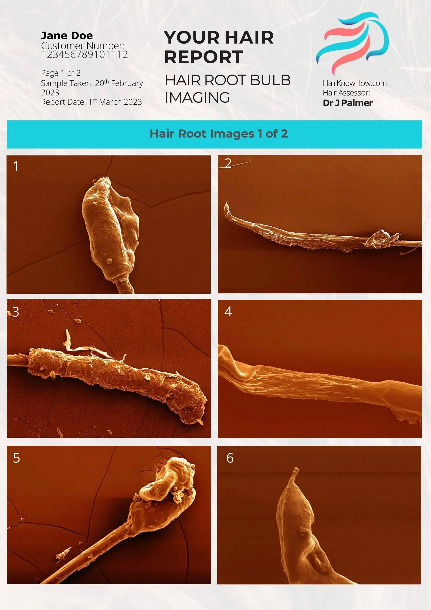 Hair Clinic Root Bulb Imaging Test: Uncover Comprehensive Insights ...