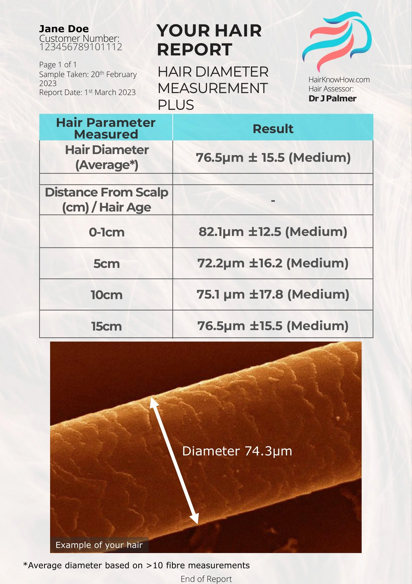 HairKnowHow - Bespoke Hair Clinic And Trichology Hair Testing Services ...