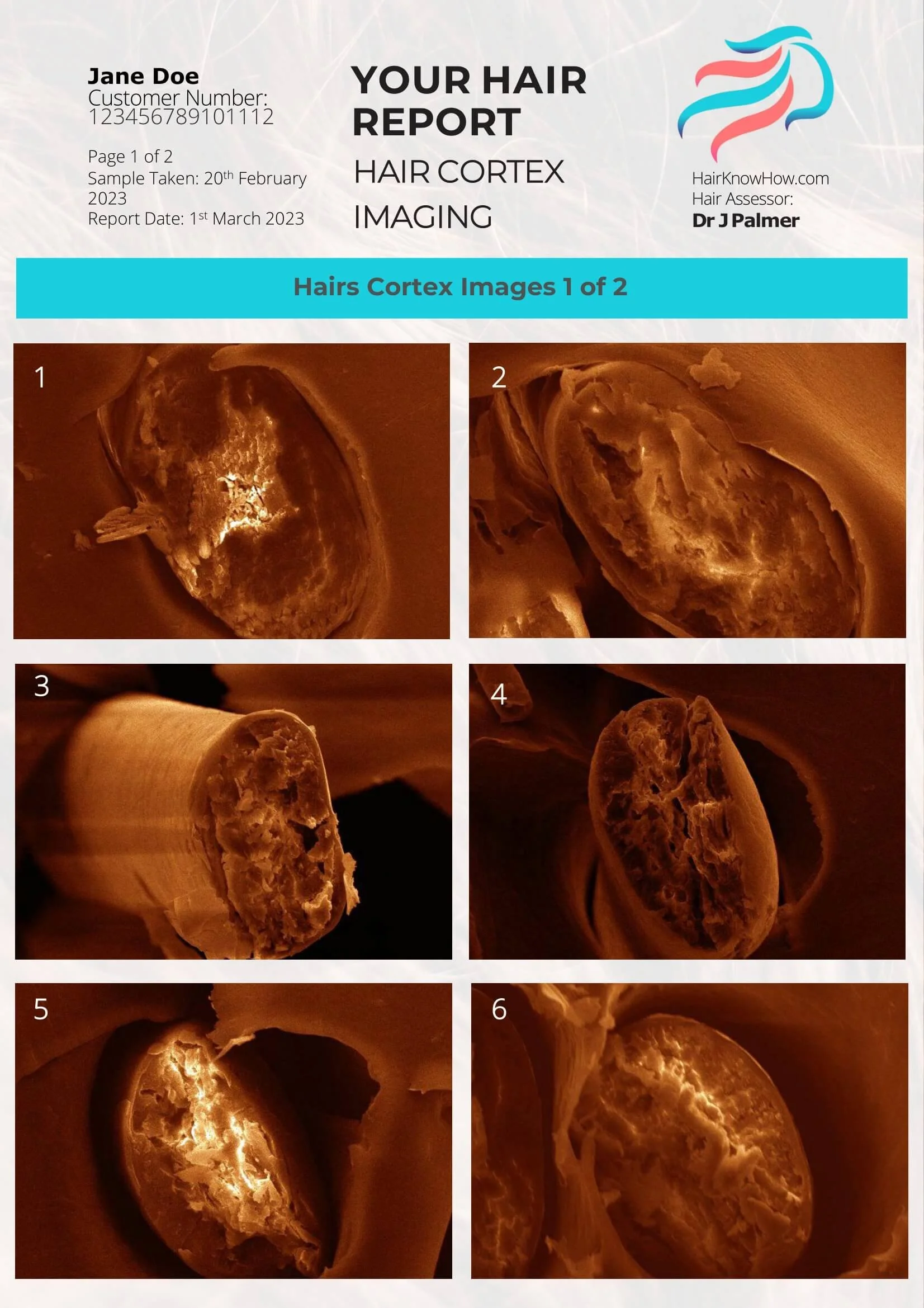 HairKnowHow: Hair Clinic Cortex Imaging Test Services — HairKnowHow.Com ...