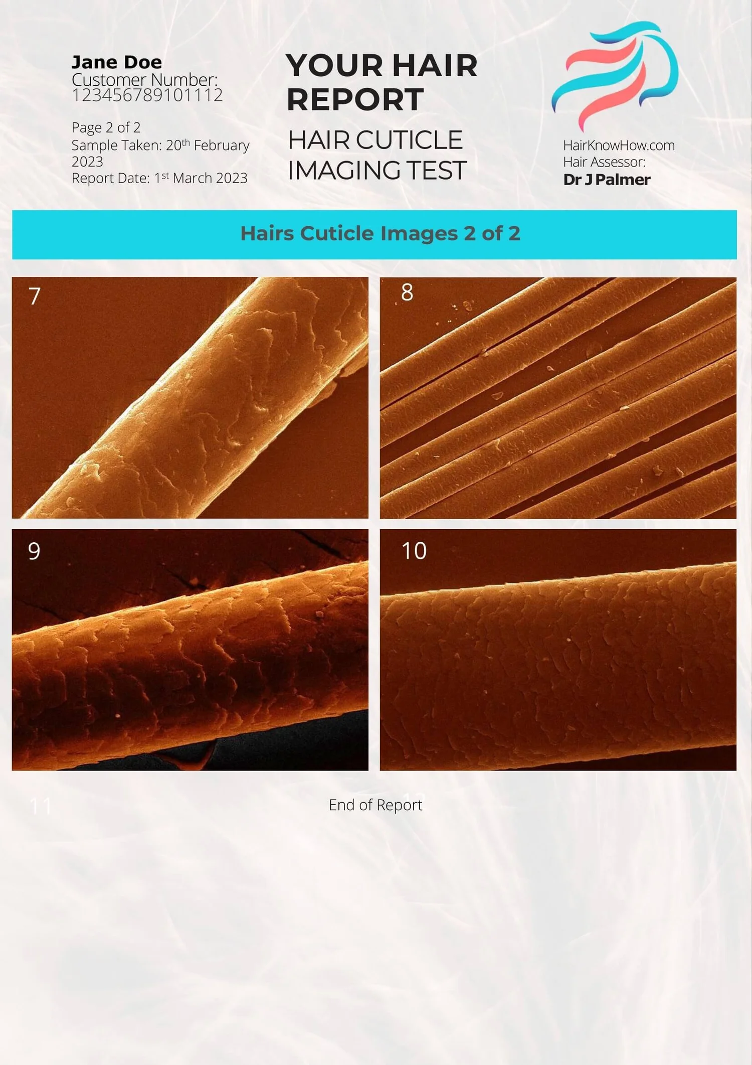 A New Hair Clinic Testing Tool - The Cuticle Imaging Test — HairKnowHow ...