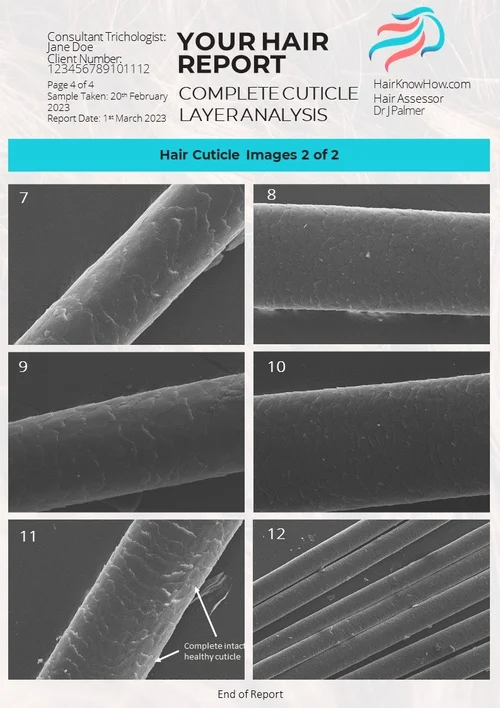 Hair Clinic Cuticle Layer Analysis - Get Deep Insights Into The Health ...