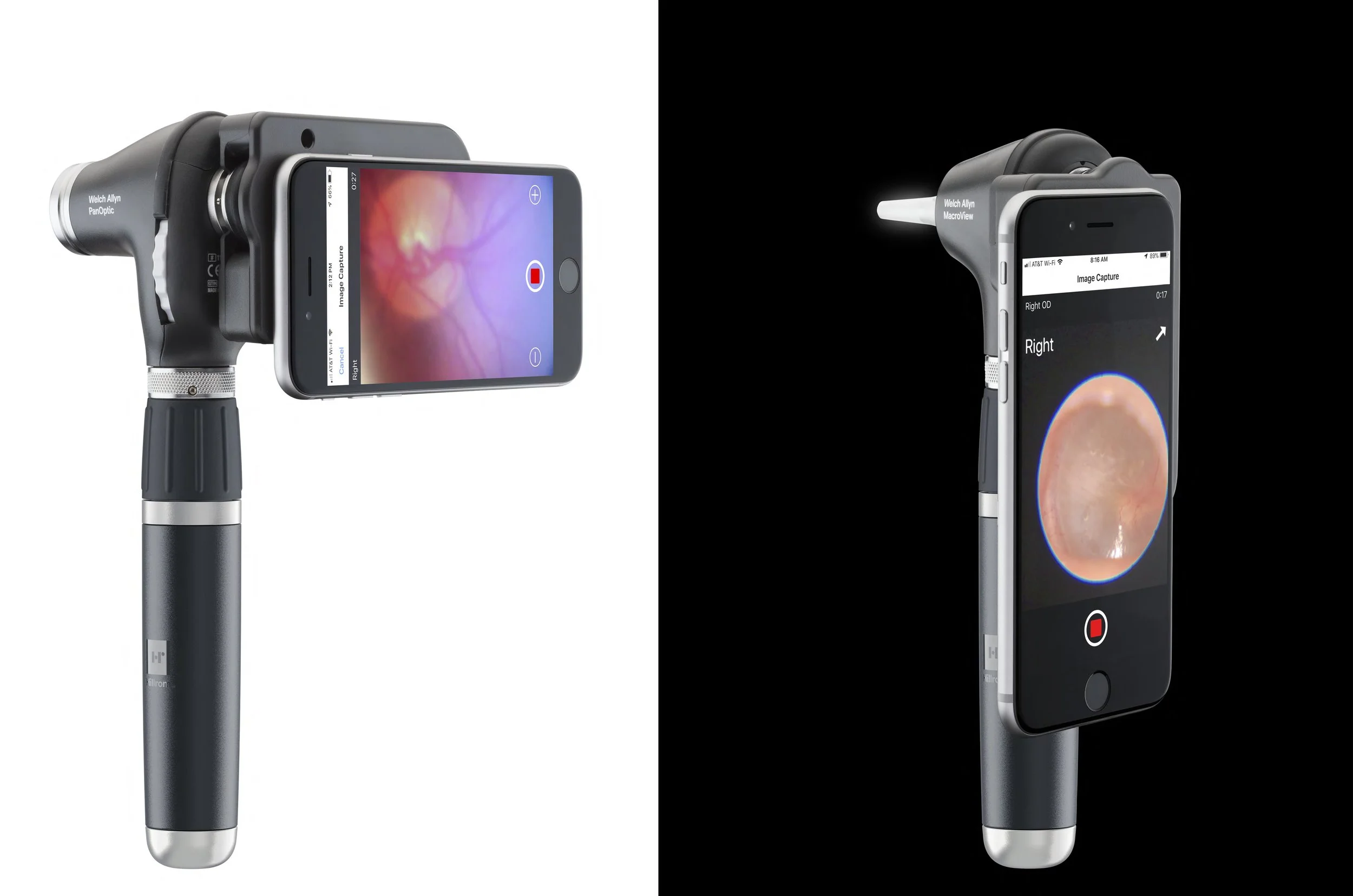 ram redesigns iconic ophthalmoscope and otoscope for Welch Allyn — ram ...