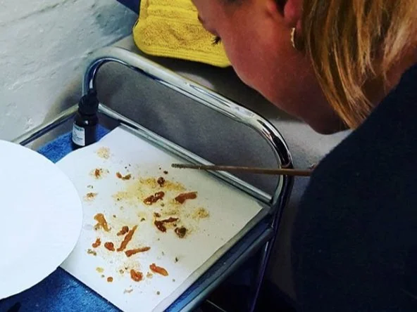 Ear Candling — Stella's Light Healing