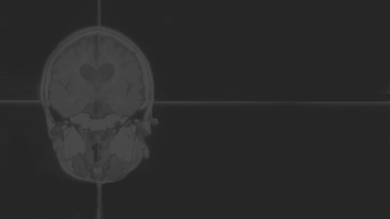 Conrad Smiles - For Pediatric Non Fatal Drowning & Inclusion