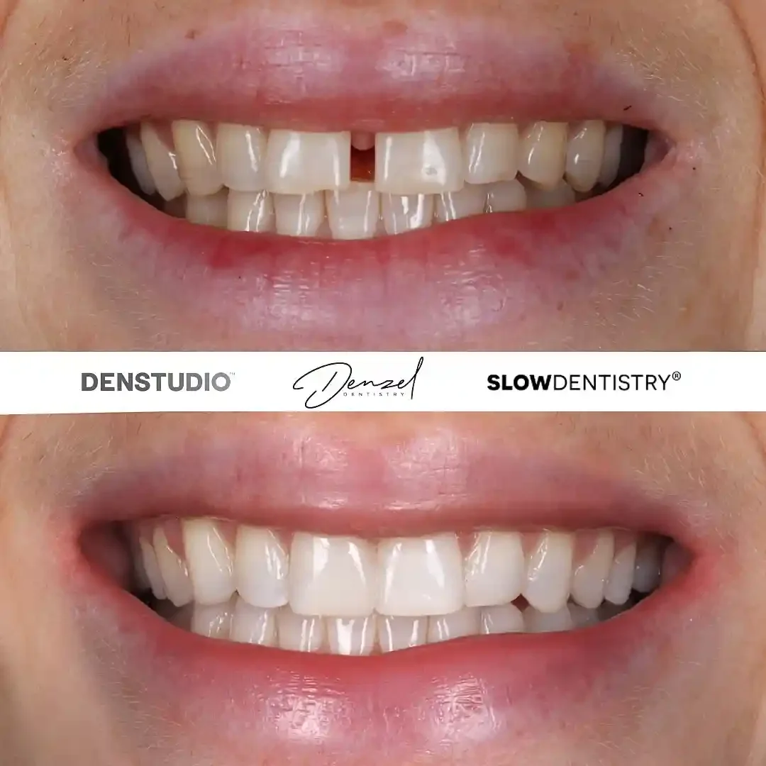 Dr Jana Denzel — London Dental Centre