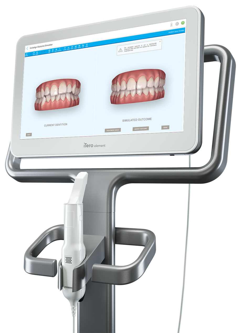 What is an iTero scanner? — London Dental Centre