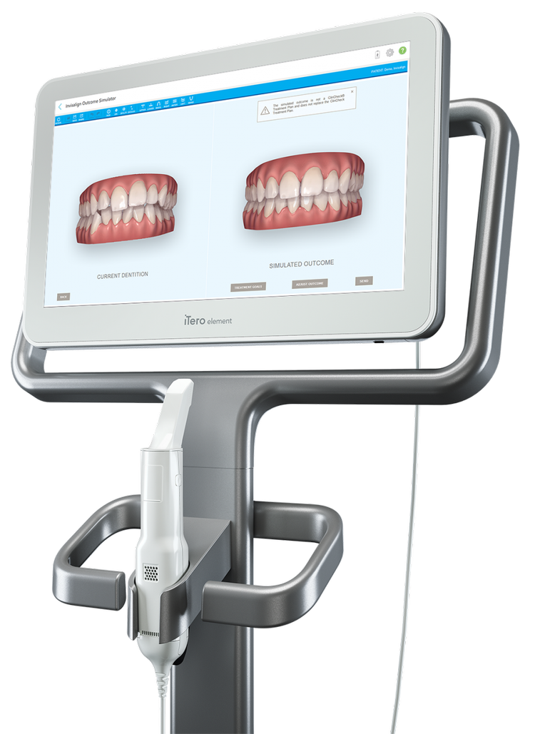 What is an iTero scanner? — London Dental Centre
