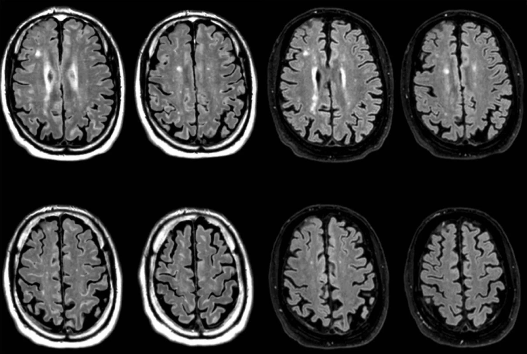 Neuro / Head & Neck — RadClarity