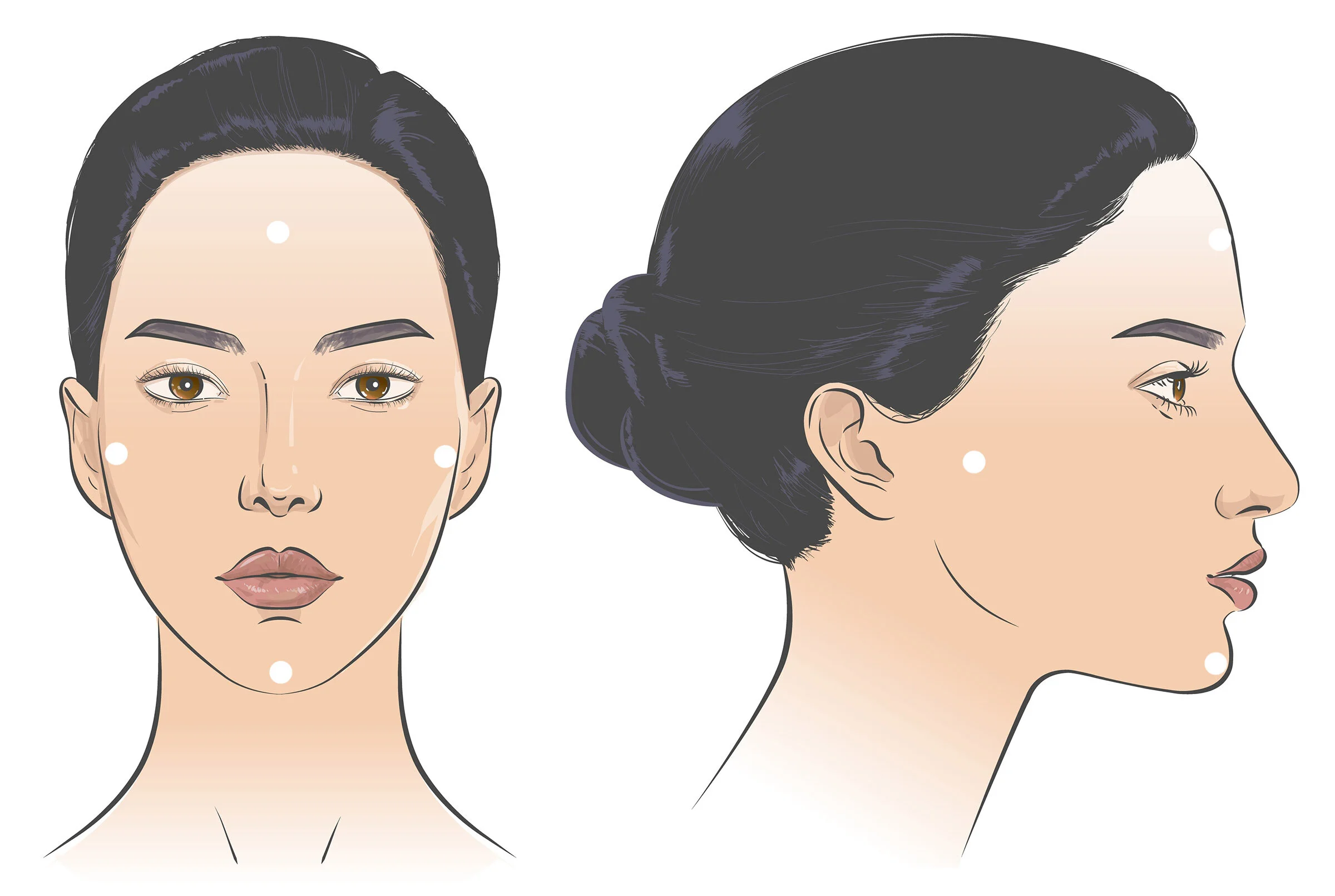Perioral dermatitis — Medical Secrets