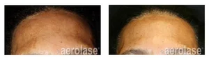 Melasma & Hyperpigmentation — Florida Institute of Dermatology