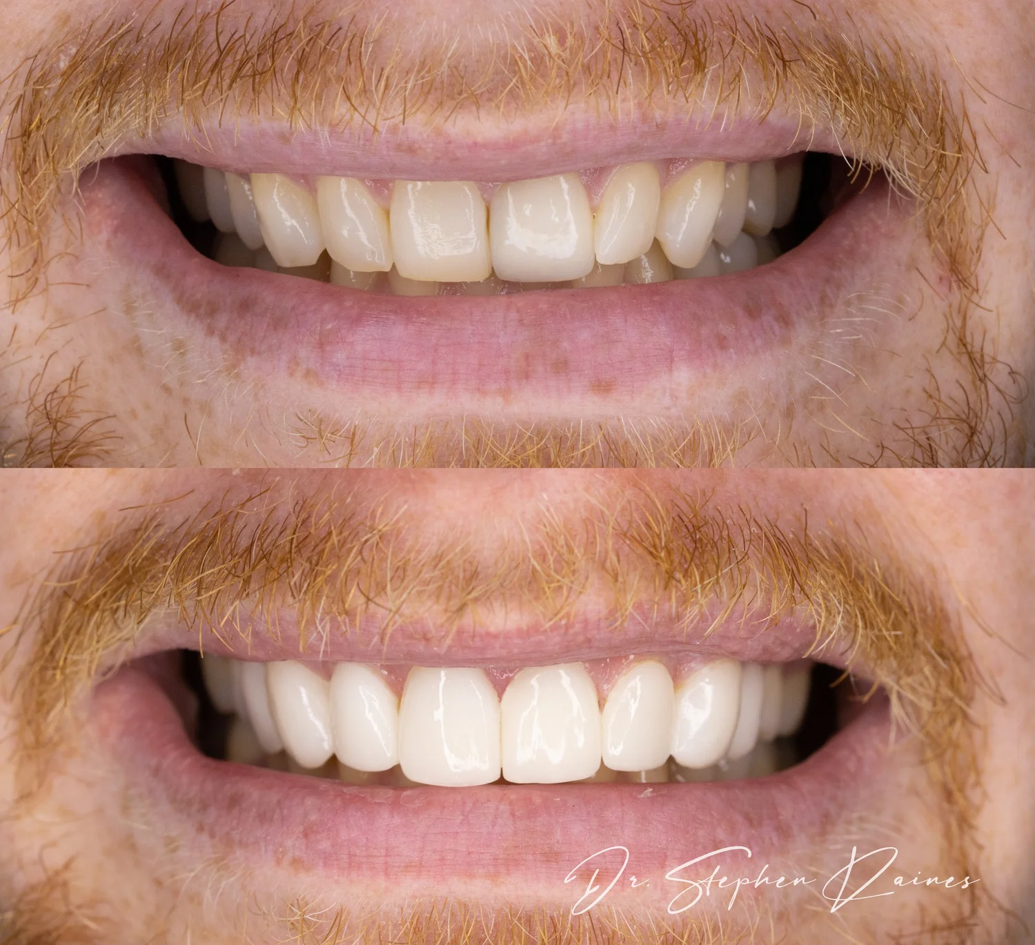 Before & After — Raines Family Dental
