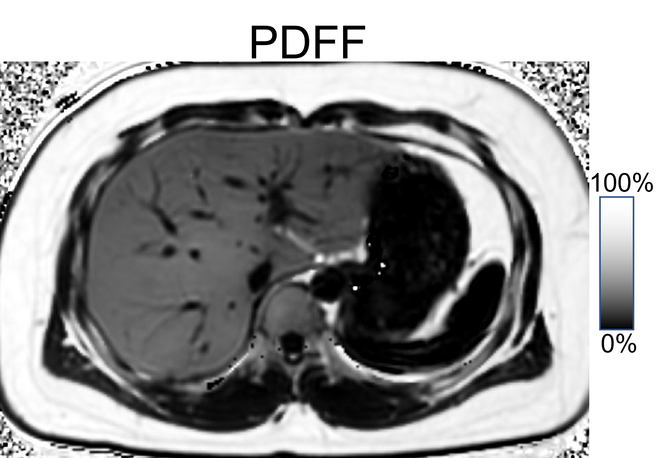General 1 — Calimetrix