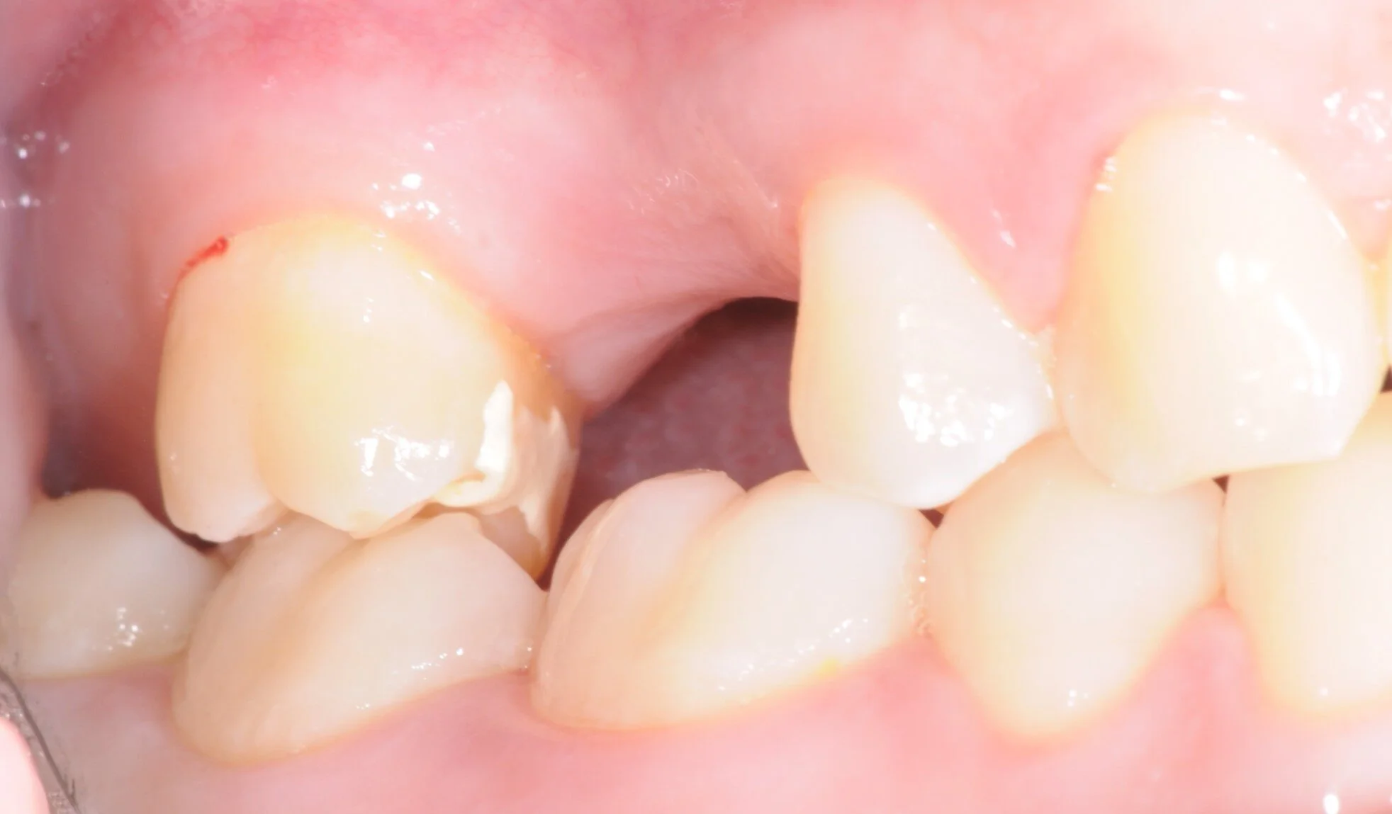 SMILE GALLERY — Devine Dental