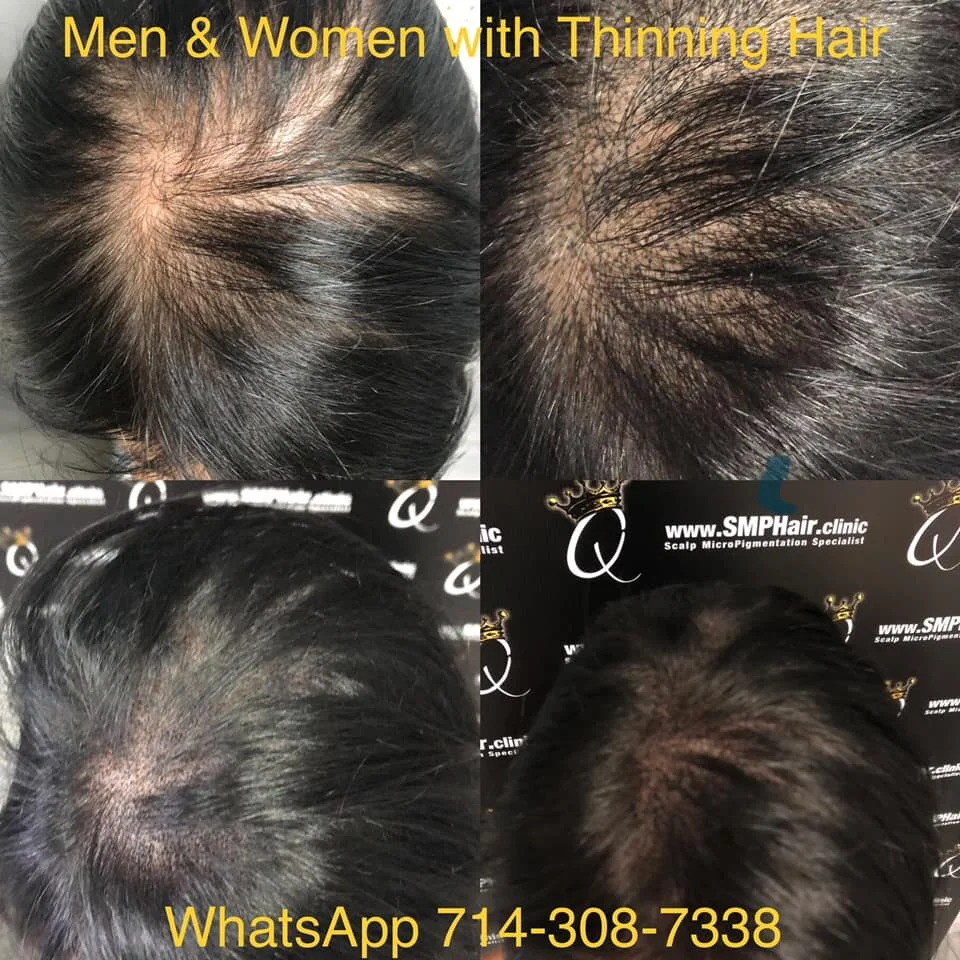 SMP HAIR CLINIC