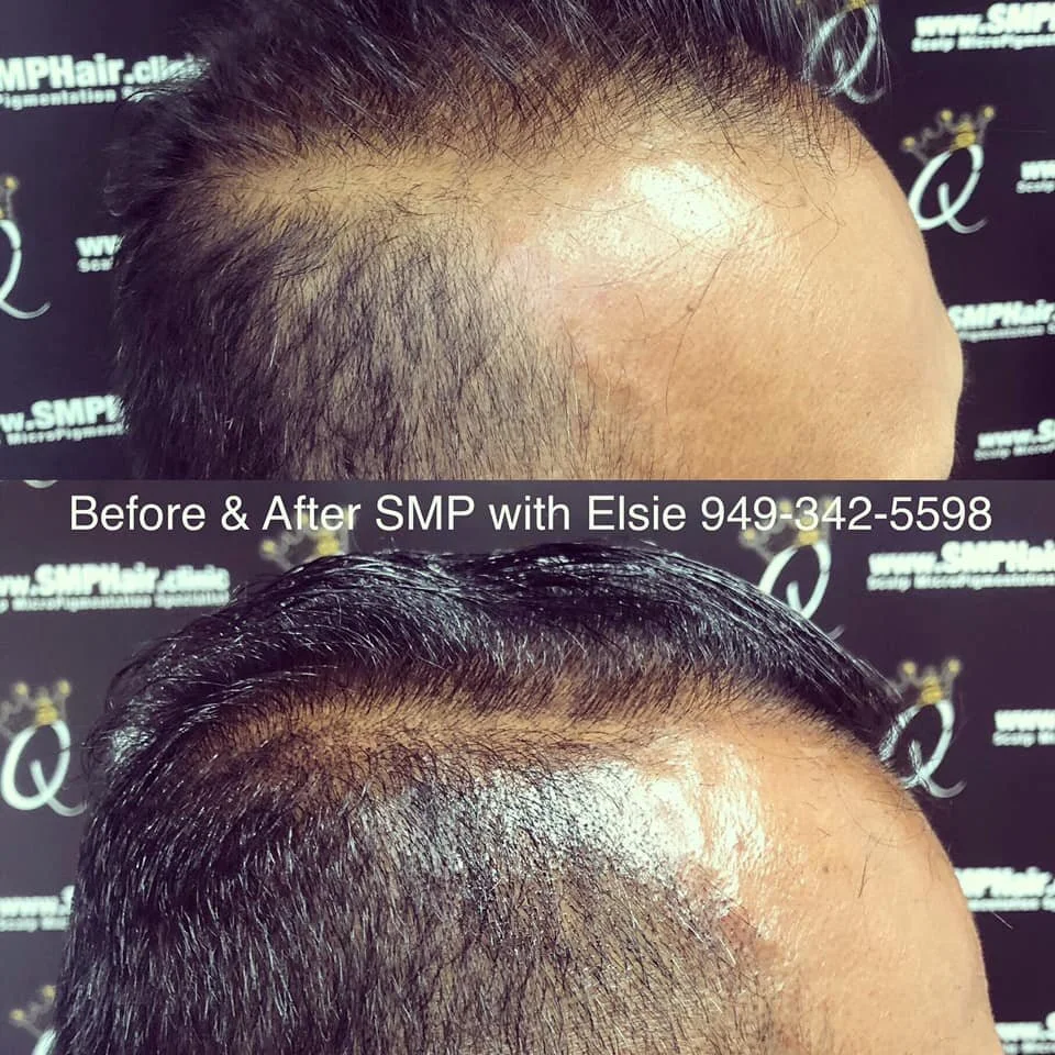 SMP HAIR CLINIC