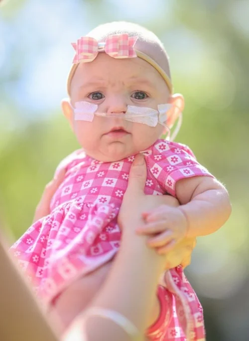 Surgery in the womb saves tiny Chelsea’s life — The Sunshine Valley Gazette