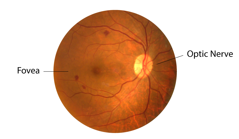 How the Eye Works — University Retina