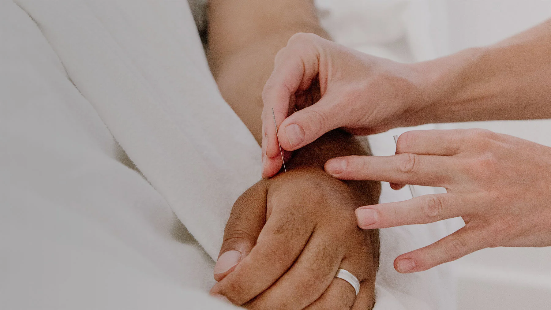 Acupuncture for Adults — wellbe family wellness