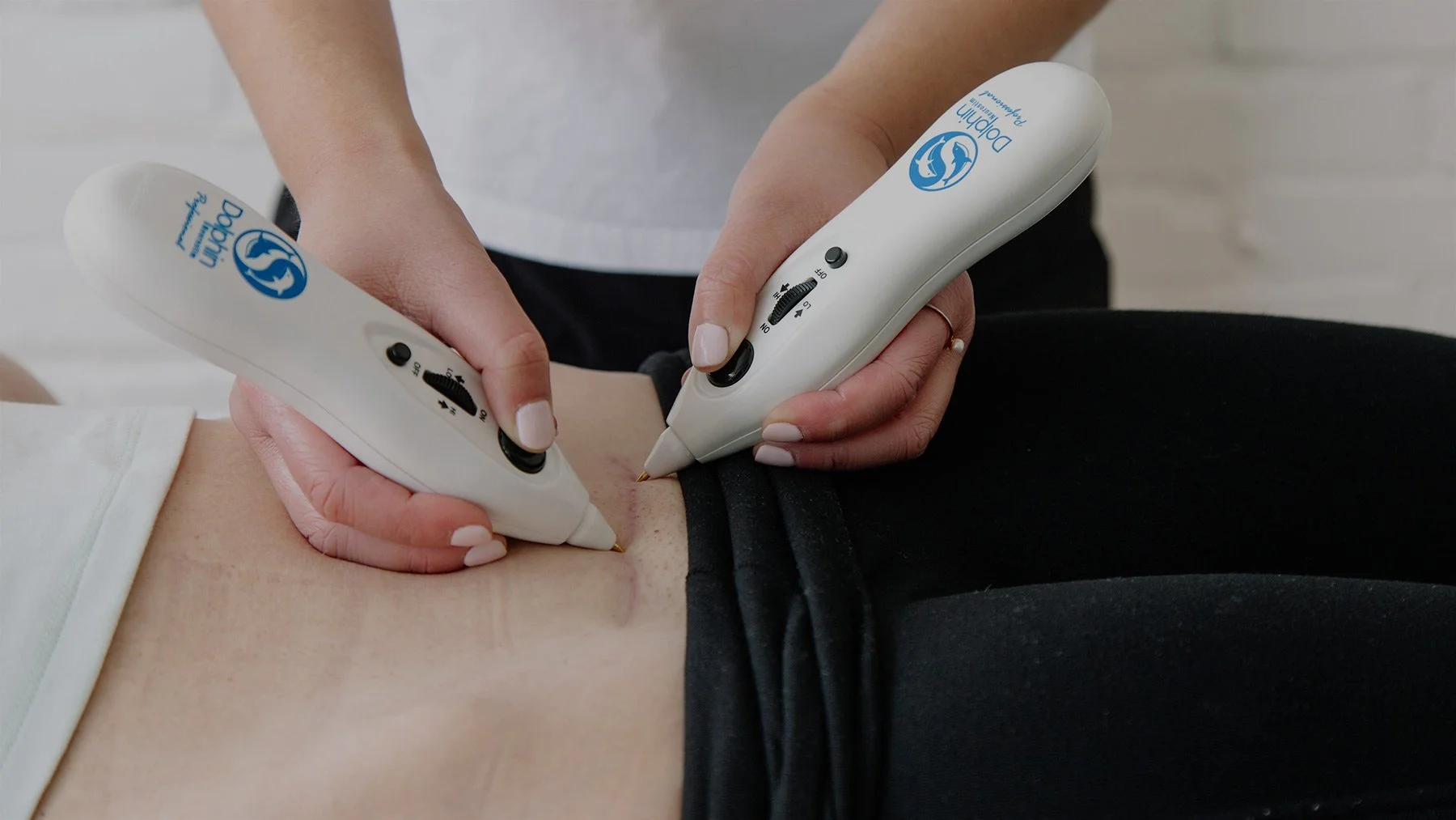 cesarean scar release therapy — wellbe family wellness