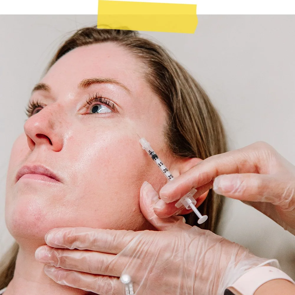 neuromodulator for aesthetics — wellbe family wellness