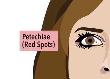 What to know if you've experienced strangulation — Caring Unlimited