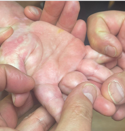 Products | STEDICAL SCIENTIFIC — Stedical Scientific