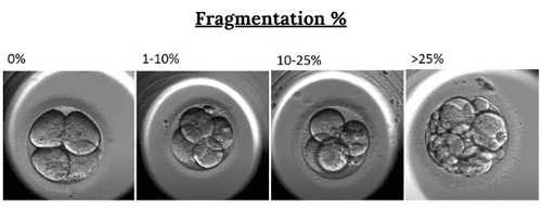 What Is a Poor-Quality Embryo? — The IVF Warrior