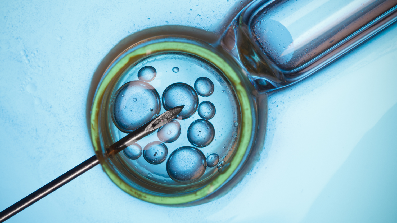 World’s First AI-Assisted IVF Baby Born | Robot-Controlled ICSI ...