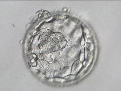 What Having a 'Perfect' Embryo Actually Means — The IVF Warrior